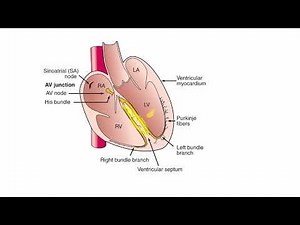 Understanding q wave- Pathological q wave
