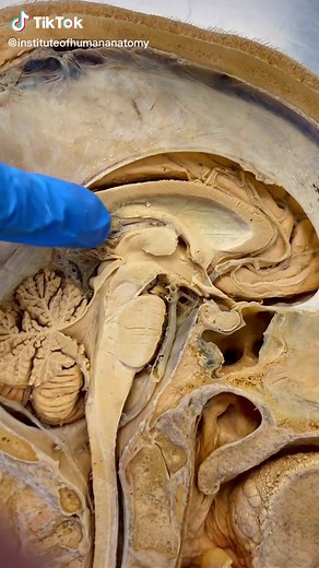 All About the Anatomy: Understanding the Corpus Callosum