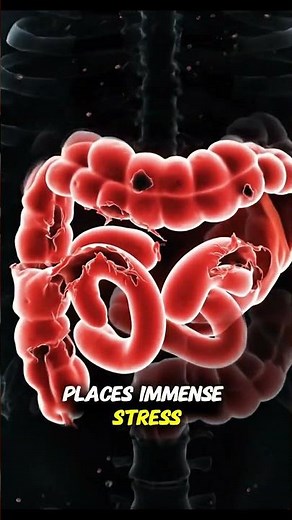 HIV in the Human Body: From Infection to Immune Damage