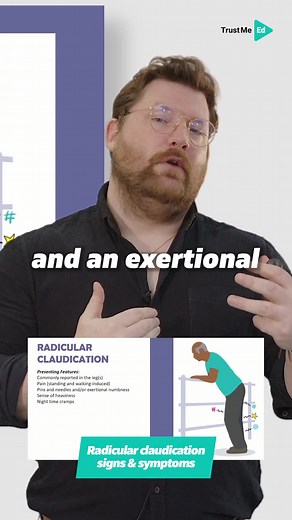 Radicular Claudication Signs & Symptoms by Adam Dobson. Clip taken from his lecture on Lumbar Spinal Stenosis at www.trustme-ed.com/lectures #backpain #lumbarspine #lumbarspinalstenosis #radiculopathy | Trust me, I'm a Physiotherapist