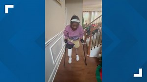 She lost her arms and legs now she is walking again