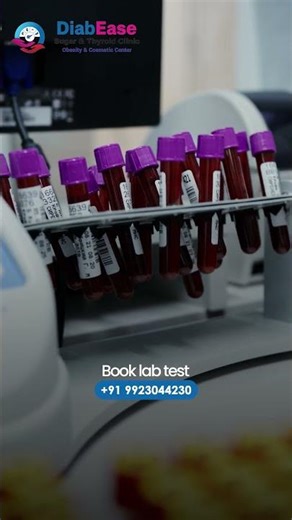 Accurate insights for better health, trust Diabease for reliable lab tests.