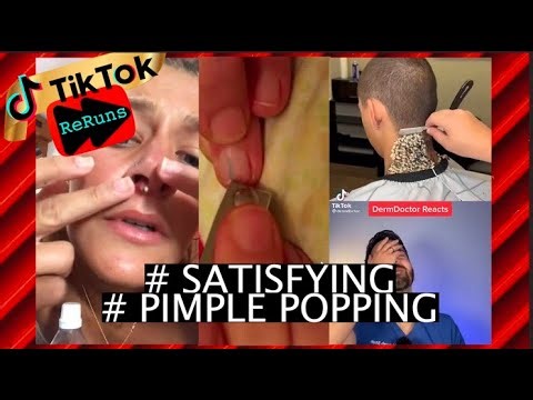 Over 15 Minutes Of Pimple Popping/ Black Heads/ Splinters - TikTok Compilation | Part 4