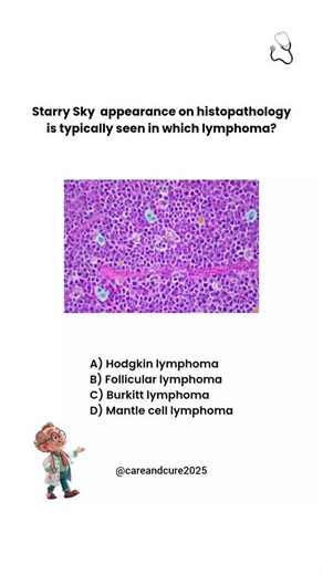 CareAndCure on Instagram: "Photomicrograph of lymph node tissue (H&E stain, high magnification). Follow @careandcure2025 for more #Medical and #Health related content. This content is for educational purpose only,not a medical advice. 📷 Source: amboss_med #medicine #medstudent #medicalschool #plab #usmle #careandcure #pathology"