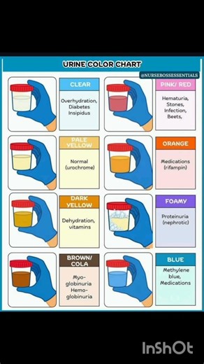 “Is Your Urine Normal? Quick Color Chart Guide!” #medicalshorts #youtubeshorts