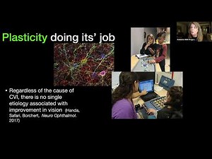 The CVI Range Approach Explained | Dr. Christine Roman-Lantzy | PCVIS