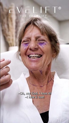 Linda's Pre-Op EVE Lift™ Consultation With Dr. Ali Charafeddine | Eden Plastic Surgery | Miami, FL