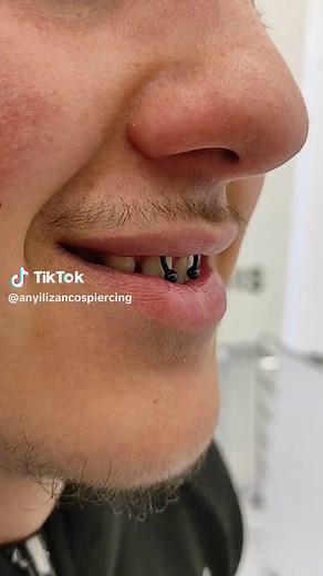 Guía completa sobre piercing smiley y su cuidado