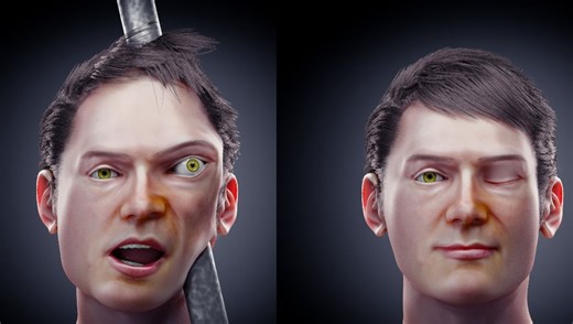 Scientists Reconstruct Face Of Phineas Gage, Who Survived An Iron Bar Through The Brain