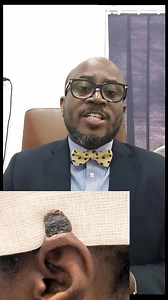 36K views · 1.1K reactions | KELOID TREATMENT | Dr. Mujajati Aaron | Facebook