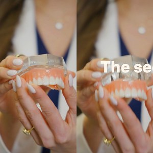 Goodbye denture glue. Hello implant dentures 👋😁 An innovative and affordable way to get beautiful, secure teeth. | Aspen Dental