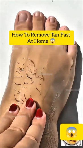 How To Remove Tan Feet Naturally at Home|Dark & Tanned Feet Whitening in 7 Days#shortsfeed#ytshorts