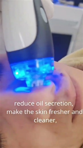 360 Rotating Vortex Nozzle = Next Level Clean B65