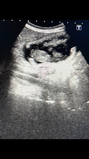 Miss Ruby from last weekends intake is pregnant! We’re assuming she’s about 2 weeks along meaning in 5-6 weeks we will be welcoming her little ones into this world with lots of love 💕 6 babies were counted today. follow to watch her journey! #pregnant #ruby #rescuedismyfavoritebreed #husky | KCS Animal Rescue Society