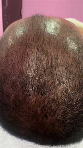 Showing off results and client’s feedback tqsm la🙏🙏🙏 kindly add me in watsapp and book your appointment #17119013#