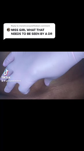 Effective Ingrown Hair Removal Techniques