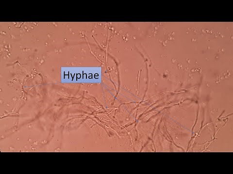 yeast cell and hyphae under the microscope