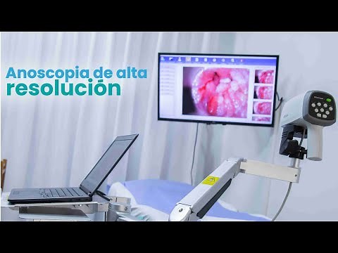 Anoscopia de alta resolución