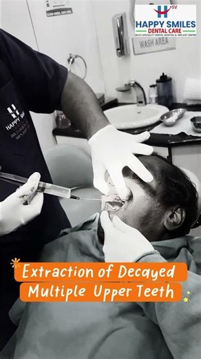 Painless Extraction Of Multiple Decayed Upper Teeth | | Happy Smiles