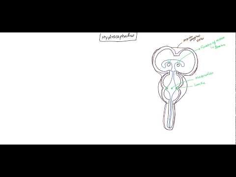 Hydrocephalus (NeuroAnatomy and Physiology of CSF) for USMLE