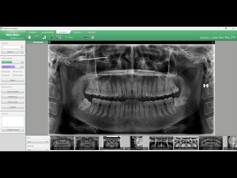How to Insert Implant in OPG and RVG in Vatech EzDent i Software
