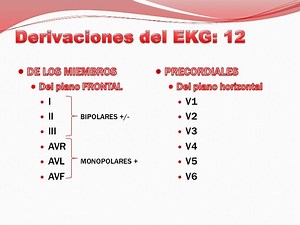 12 Derivaciones Del Electrocardiograma Normal