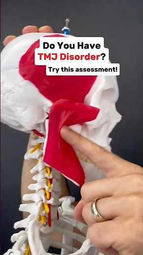 What’s causing your TMJ? Try this assessment! #tmj #tmjtreatment