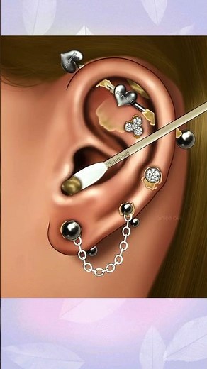 Deep Ear Cleaning and Ear Wax Removal | Relaxing Sounds #asmr #earcleaningasmr