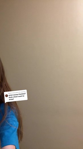 Freckles Explained: UV Rays, Genetics & More!