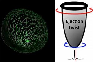 LV torsion viewed through the apex: •counterclockwise twist at apex •clockwise twist at base What you are seeing is correct, but you are looking at it from the base towards the apex. The default way to look at it is from the apex towards the base (as the dynamic LV model shows). | Cardiophilia