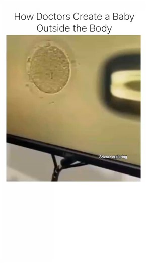 Science | This is how doctors create a test-tube baby step by step. In IVF, the egg and sperm are carefully taken, combined in a lab, and allowed to... | Instagram