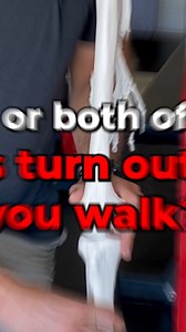 1.7K views · 16 reactions |  Do your feet always turn out when you...