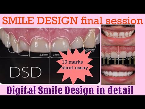 SMILE DESIGN final session.DIGITAL SMILE DESIGN in detail