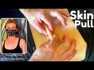 *SKIN PULL* ~ LOW BACK PAIN "95% GONE"!