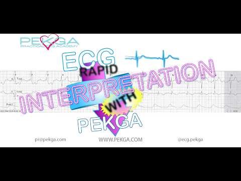 PACEMAKER ATRIAL FLUTTER - RAPID ECG - PEKGA