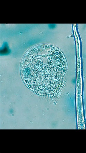 POV: Your microscope light is TOO powerful 🔬🔥