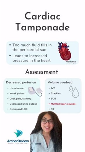 17K views · 384 reactions | One possible cause of cardiogenic shock...