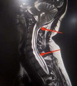 27K views · 106 reactions | #MRA #mri #DWI #radiology #lesions | CT Scan and MRI study | Facebook