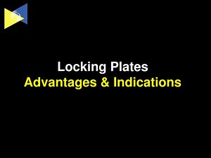 Locking Plates Advantages &amp; Indications - SlideServe