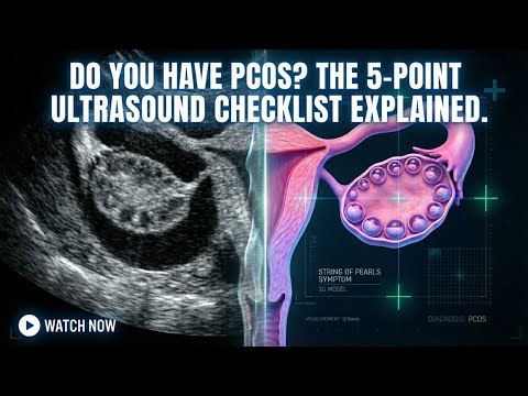 Do You Have PCOS? The 5-Point Ultrasound Checklist Explained