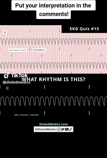 Paramedic and Nurse Training Videos | EKG, ACLS, and More