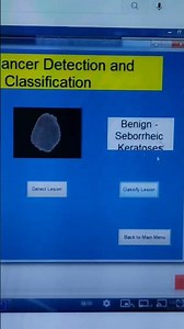 SKIN CANCER DETECTION AND CLASSIFICATION