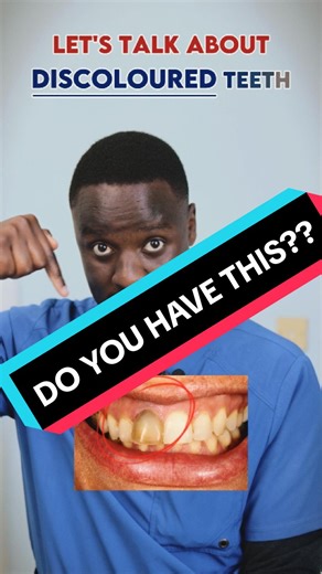 NO JOKES IN THIS EPISODE... Just facts. #drtaku #hararedentist #dentalknowledge #zimdentist #whitening #rootcanal #apicectomy #crowns #bleaching #veneers