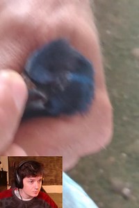 Reacts to Botfly Removal Rescue Animals🤩#botflyremoval #maggot #removal #botfly #amazing #botflylarva #satisfying #veterinary #larvae #dog #dogs #cat #cats #animals #botfly #botflyremoval #botflymaggot #botflylarva #botflyeggs #botflylarvae #botflyworm #loveanimals #lovedog #lovedogs #animalsoftiktok #virall #viralvideo #lovecat | Hit videos