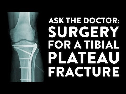Ask the Doctor: Surgery for a tibial plateau fracture