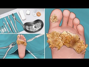 145K views · 1.4K reactions | Foot care animation asmr - Mood For Fun | Mood For Fun | Facebook