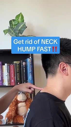 Neck Hump Exercises: Simple Stretches for Posture Correction