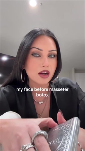 Transform Your Look: My Masseter Botox Journey