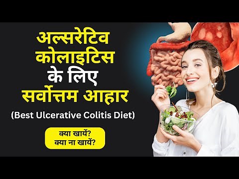 Ulcerative Colitis Diet - What to Eat and What to Avoid?