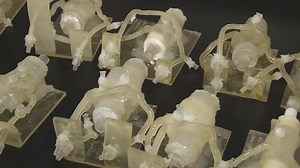 3D-Printed heart, brain models change the way doctors prepare for surgery